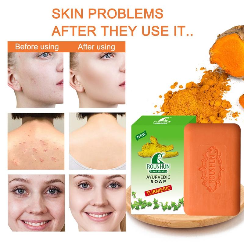 Original Turmeric Soap Whitening Acne Removal Ginger Soap Oi - TikTok ...