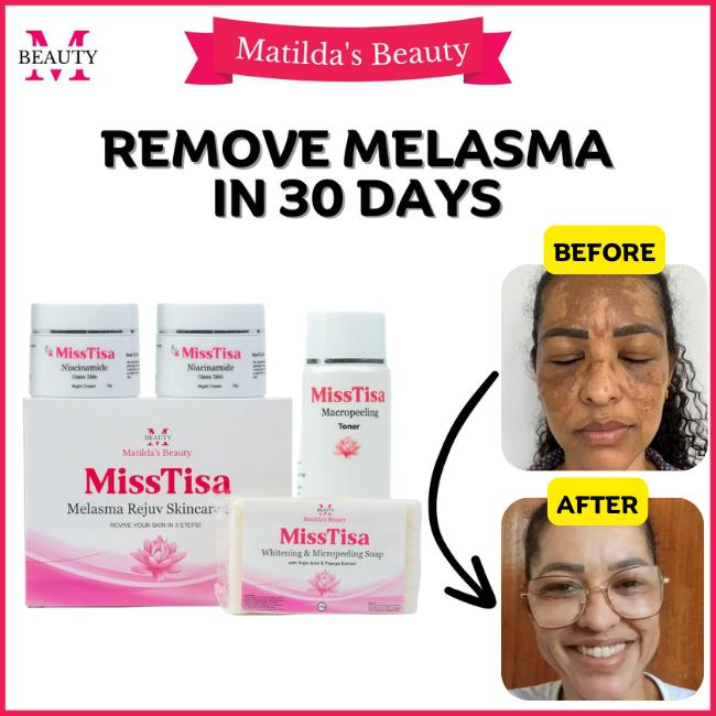 MissTisa Melasma Rejuvenating Set Original Melasma Cream wit - TikTok ...