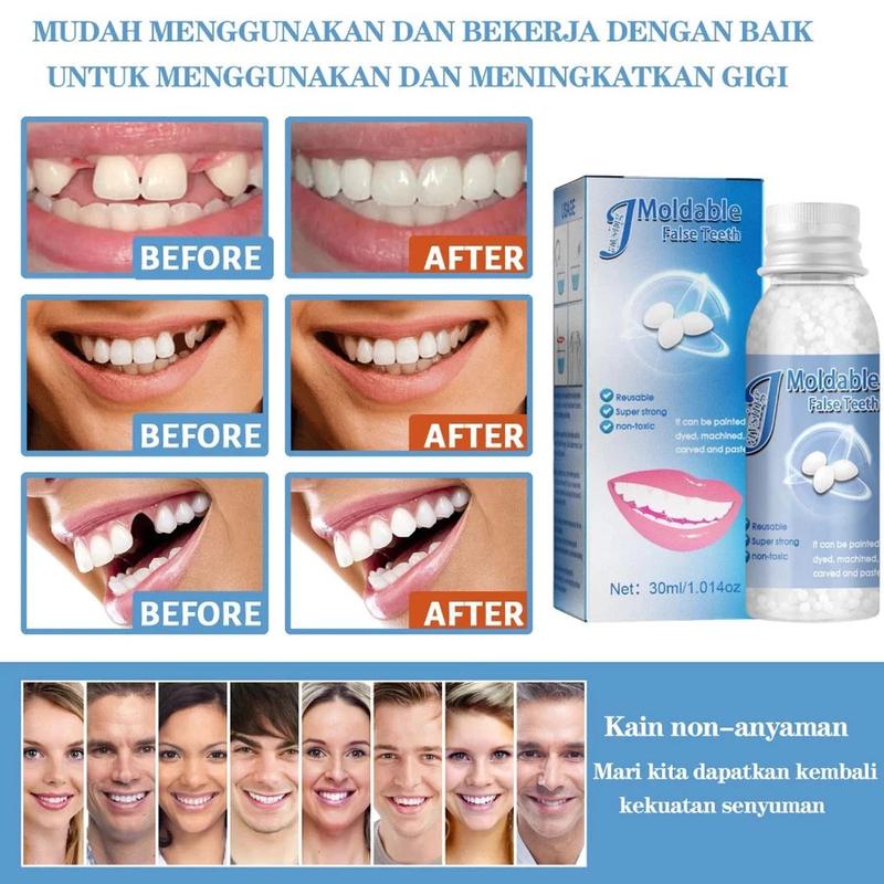 [Bestseller][Penampilan Gigi Biologis]Perekat Resin Tambal Gigi ...