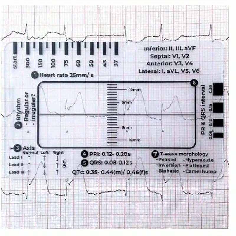 ECG 7-step Ruler, 1 Count Portable ECG Ruler, Heart Rate Measuring ...