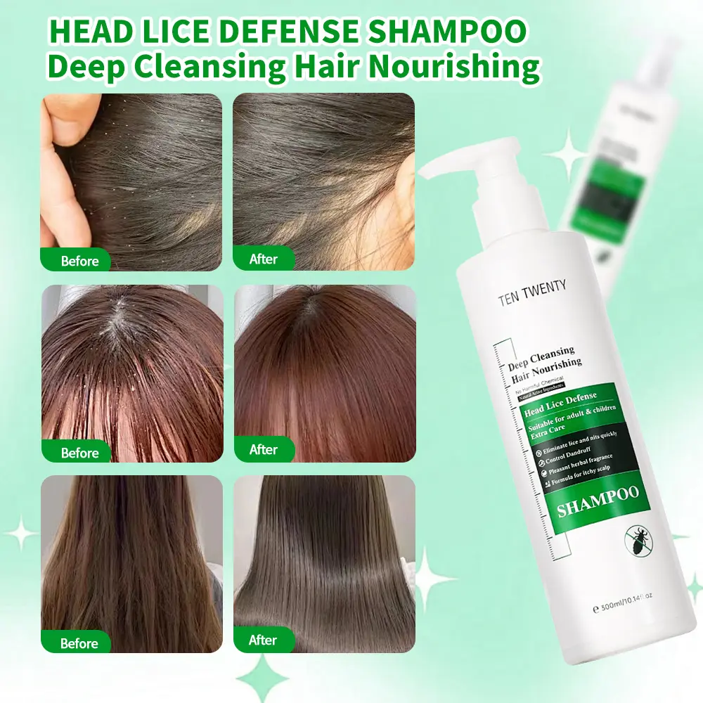 TEN TWENTY Head Lice Defense Shampoo | Fast Lice/Nits Removal + Itchy ...